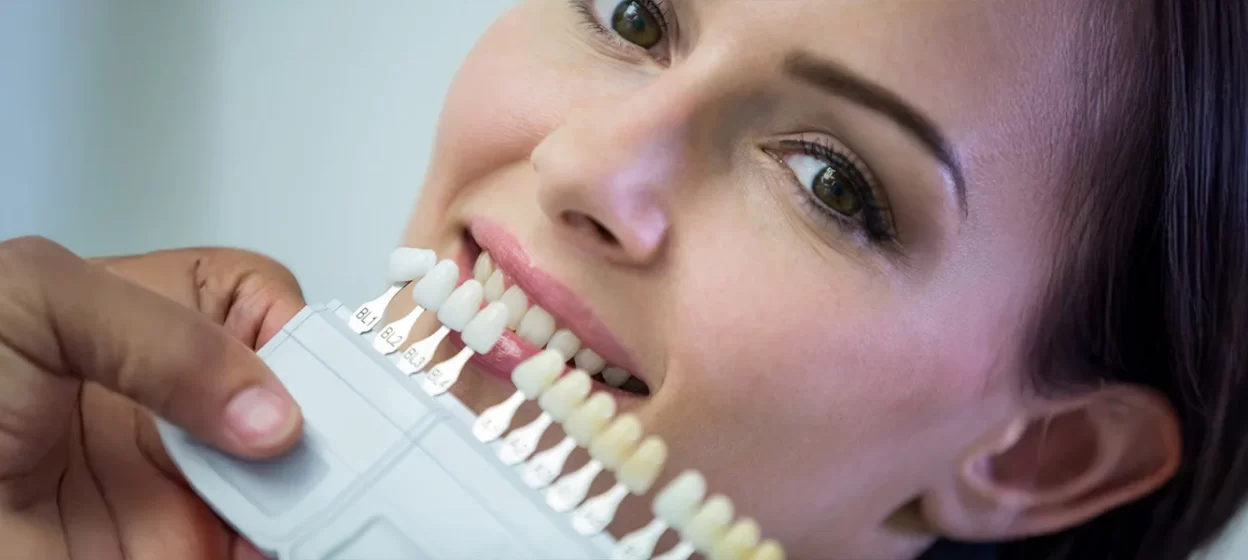 The Step-by-Step Process of Getting Dental Veneers